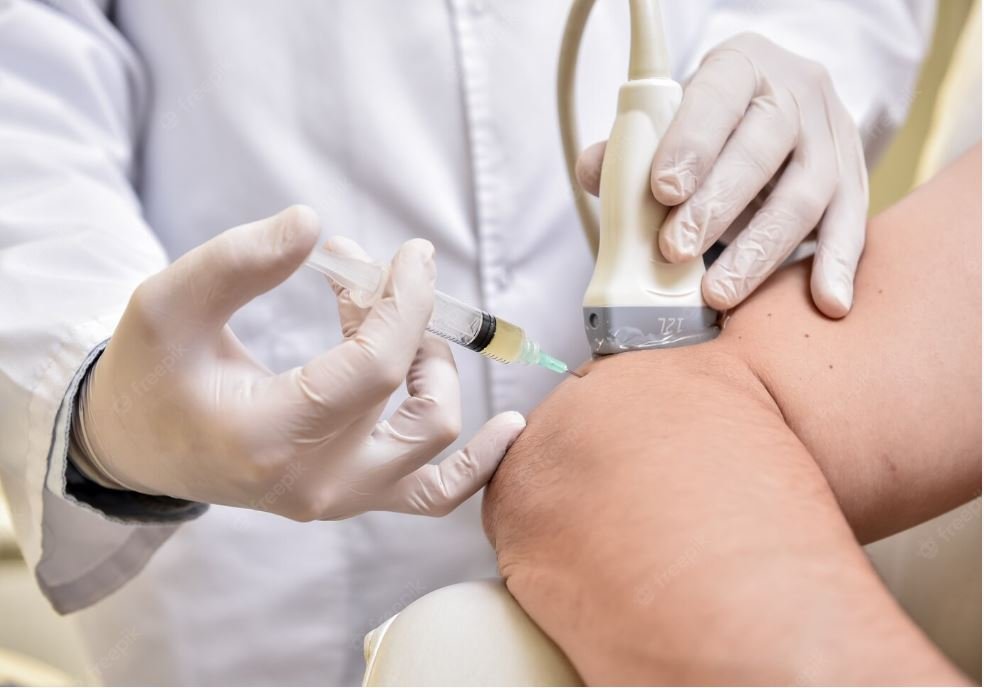 Ultrasound Guided Injection - Fusion HealthCare