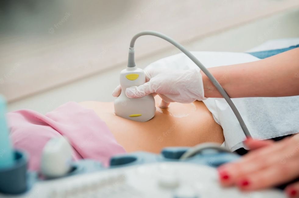 What is an Ultrasound scan? - Fusion HealthCare