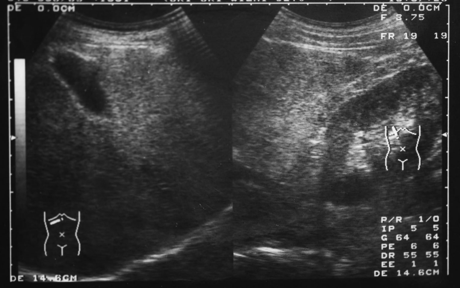 Fertility Ultrasound Scan - Fusion HealthCare