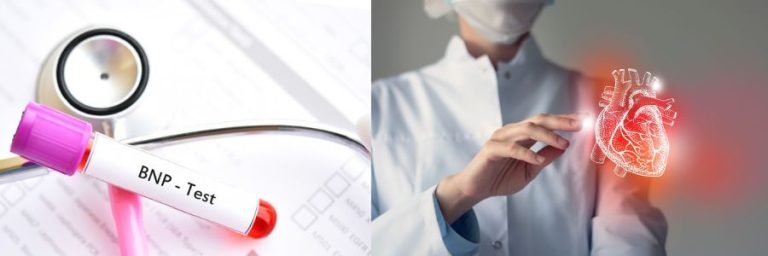 Healthy Heart Blood test (BNP) - Fusion HealthCare