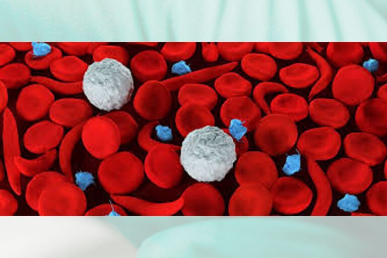 Sickle cell blood test What is it and should you get tested? - Fusion ...